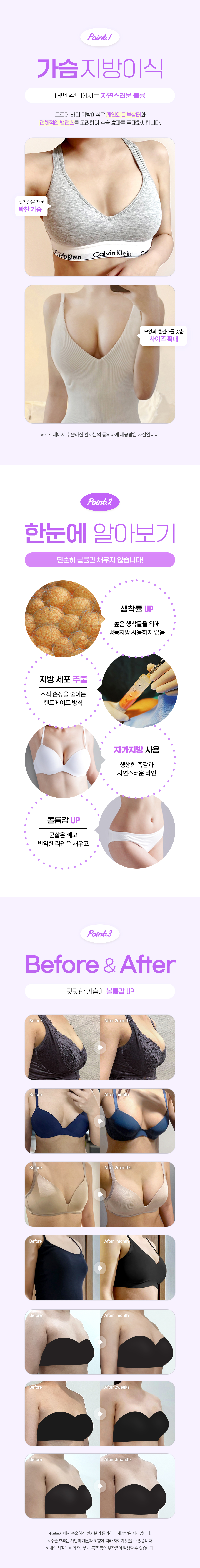 르로제 자연볼륨 가슴지방이식 - 르로제의원